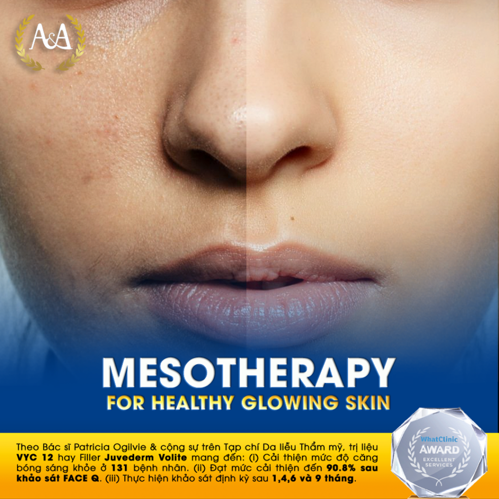 Why should you choose mesotherapy for Healthy skin? - AA Clinic A & A ...